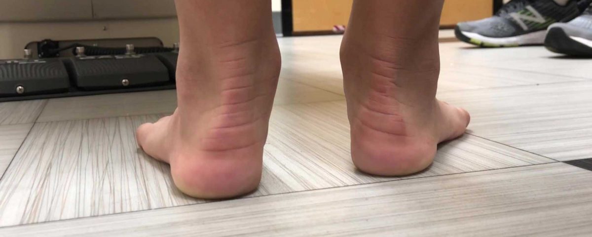 What Causes Adult-Onset Flat Feet? - Palmetto State Podiatry